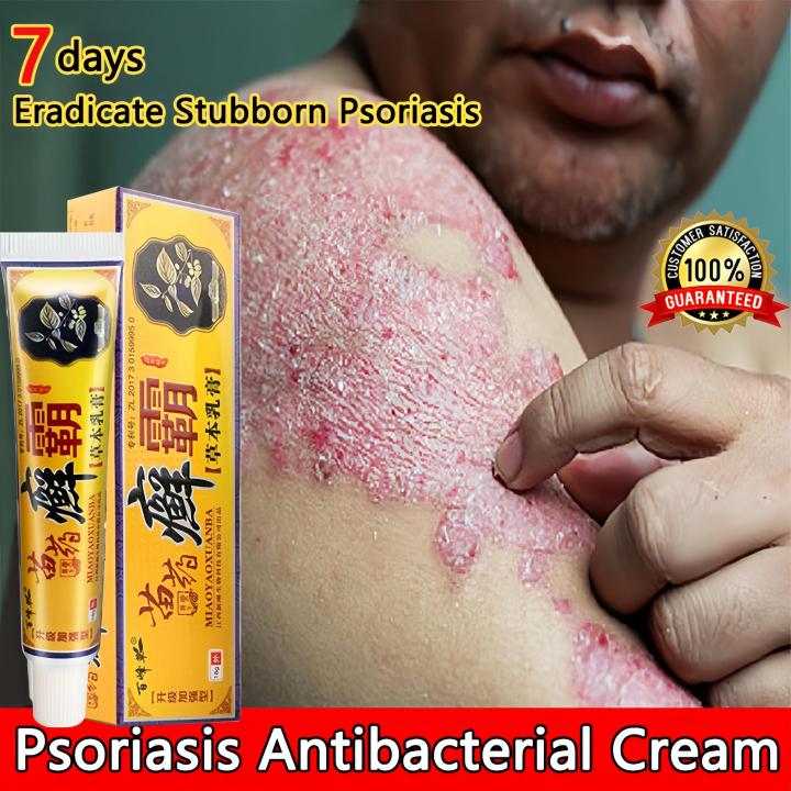 【Gamot Sa Kati Kati】Sumifun Eczema Treatment Cream Atoderma Cream ...