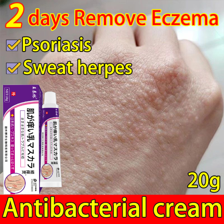 Japan👍 Antibacterial Cream 20g 3 Seconds To Relieve Itching Sweat Herpes Treatment Ointments for ...