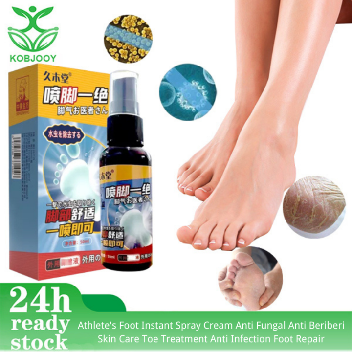 Athlete's Foot Instant Spray Cream Anti Fungal Anti Beriberi Skin Care ...