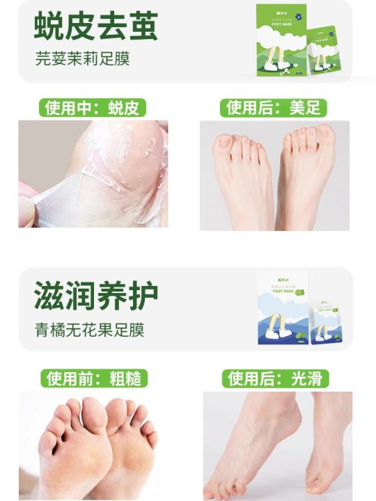 Zhenbuer Foot Membrane Nursing Heel Cracked, Whitening and Replenishing ...