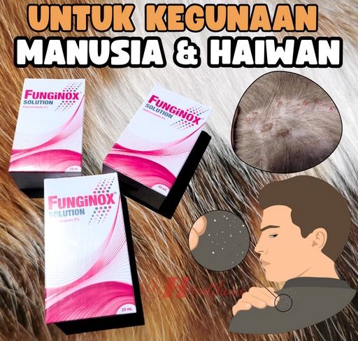 FUNGINOX SPRAY 25ML UNTUK KELEMUMUR DAN KULAT | Lazada
