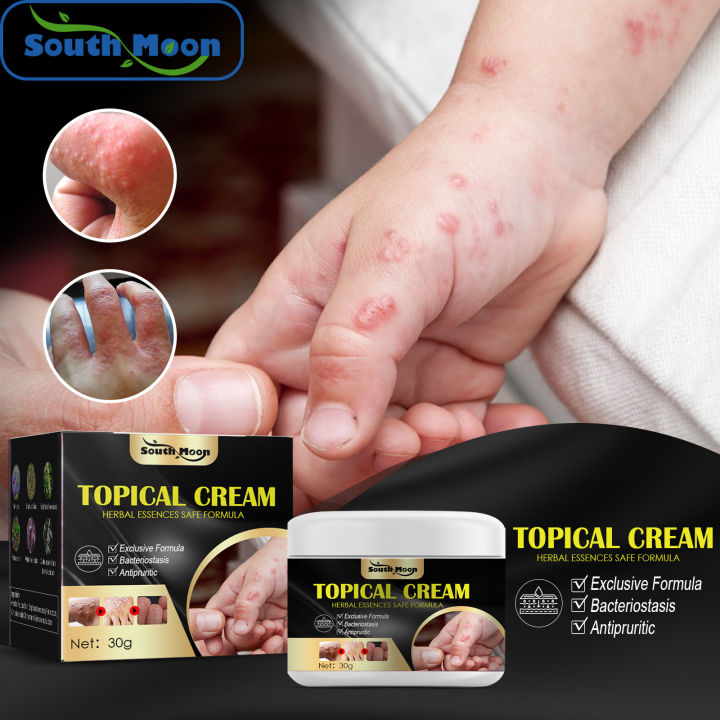 South Moon Topical Cream Mosquito Cream Children Adults Repellent Fast ...