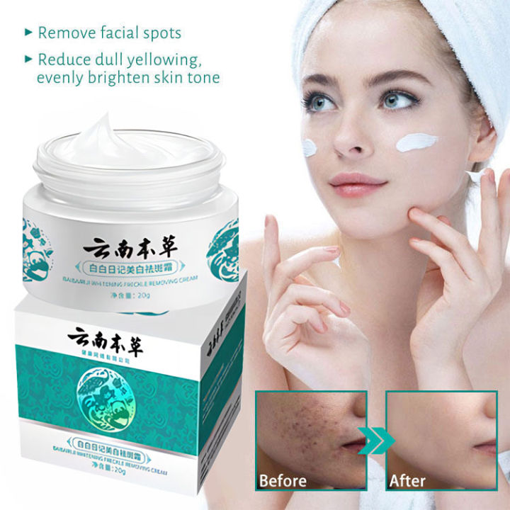 Japanese Melasma Cream Whitening Cream Original for Face Remove Dark ...