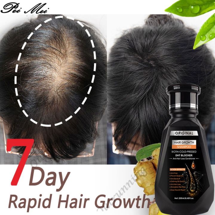 PEIMEI ginger shampoo hair grower hair growth horse shampoo ng kabayo ...