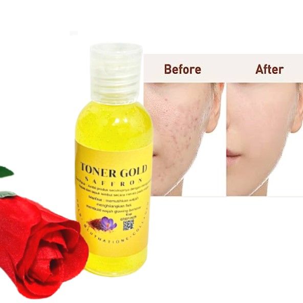 Gold Toner hydrating toner | Lazada Indonesia