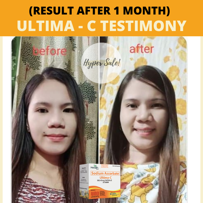 ULTIMA C (30capsule) Vitamins na pampataba 100% SAFE AND EFFECTIVE ...