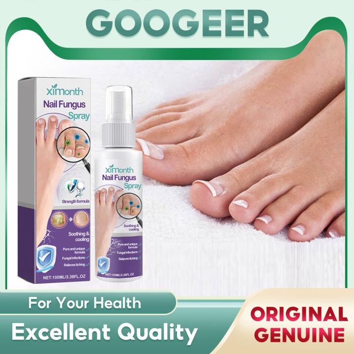 Ximonth Nail Fungus Spray Effective Repairs Toenail&Fingernail ...