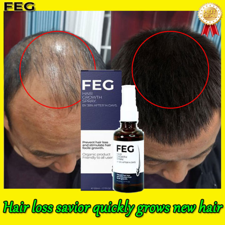 Rapid hair growth Hair Growth 50ml hair care effectively stimulates ...