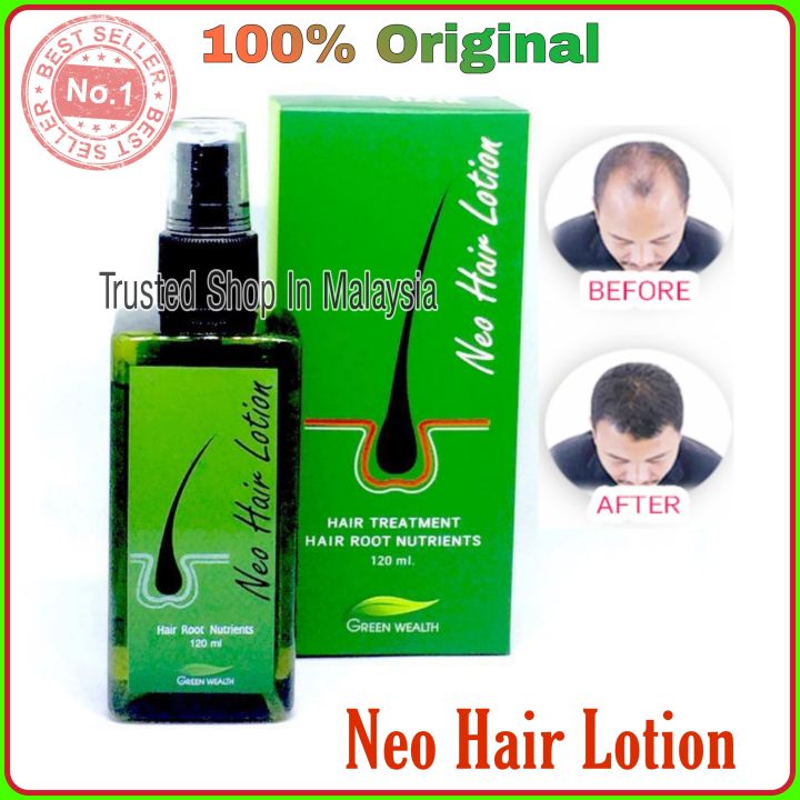 Neo Hair Lotion 100% Original 120ml Hair Spray Hair Transplant and Hair ...