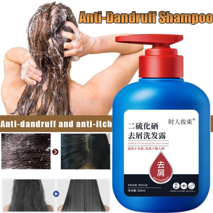 Selenium Disulfide anti dandruff shampoo kelemumur treatment dandruff ...
