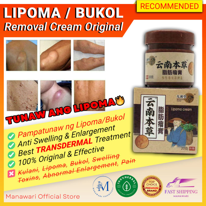 JIUXANG Lipoma Removal Cream Original Japan Lipoma Cream Bukol Original ...
