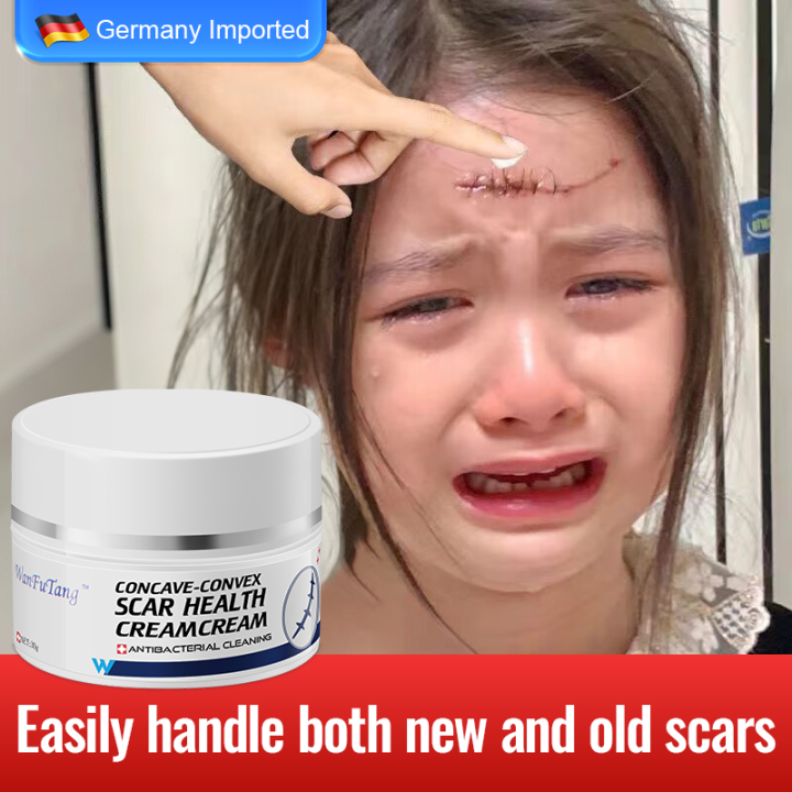 Effective Scar Remover Peklat Remover Scar Remover Cream for Old Scars ...