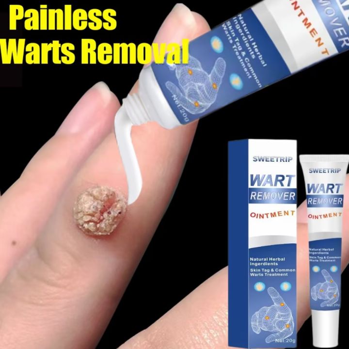 7 days Effective Warts Remover Original Cream Warts Magic Remover Wart ...
