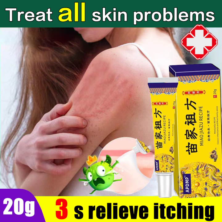 Psoriasis Eczema Cream 20g Anti Itching Psoriasis Cream Chinese Herbal