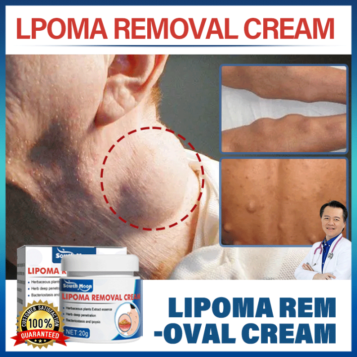 lipoma removal cream original lipoma cream bukol original lipoma ...