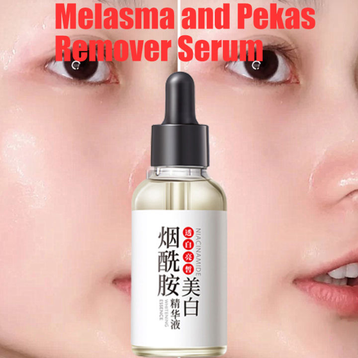 Melasma and pekas remover serum, dark spot remover for face melasma ...