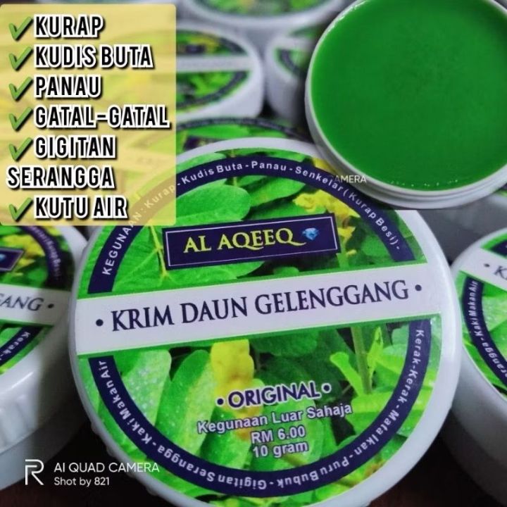 SALEP ACNE KRIM DAUN GELENGGANG AL AQEEQ 10g | Lazada