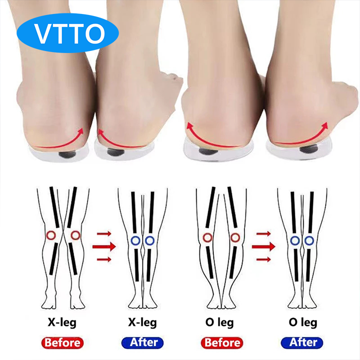 VTTO 1 Pair Magnet Silicon Orthopedic Insoles Foot Care Tool For Men ...