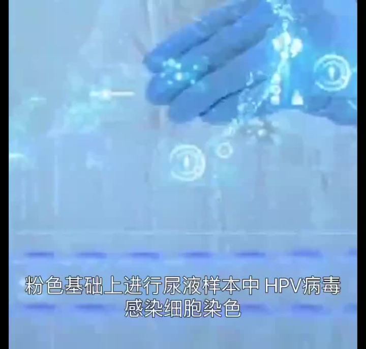 HPV Urine Test Strips Gynecological Testing Self-Check Tool Home Rapid ...