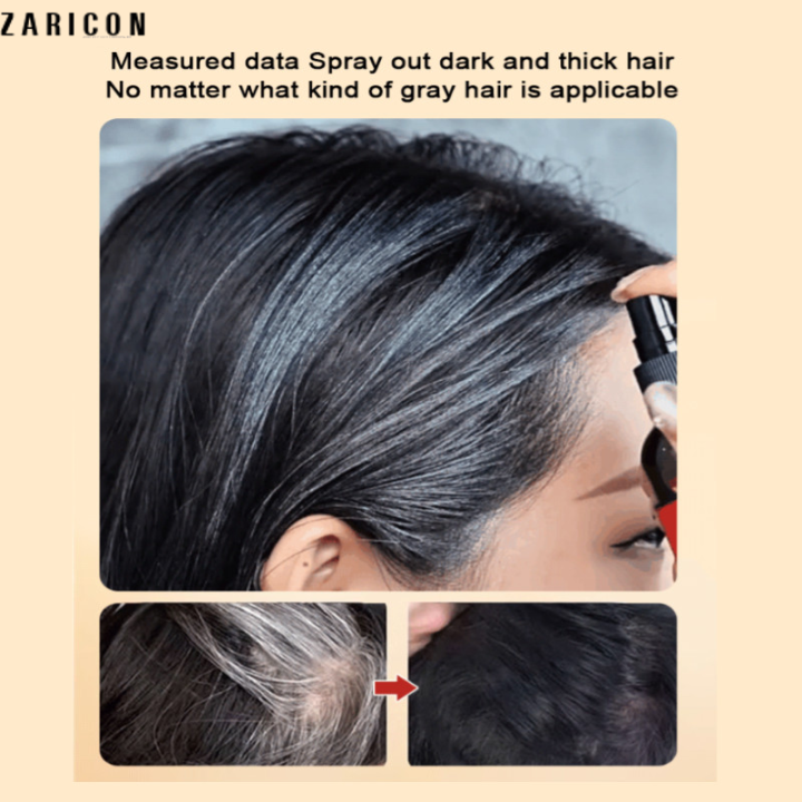 SG HOT Grey Hair No Longer Grows Saffron Essence Spray Instant Hair ...