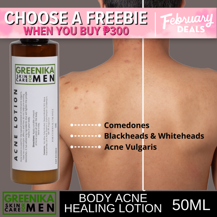 [ Anti Acne Lotion For Men ] Greenika For Men Body Acne Healing Lotion