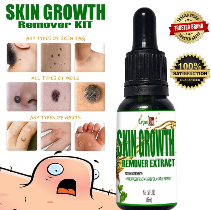 100% ORGANIC HERBAL SKIN GROWTH REMOVER EXTRACT / Skin growth remover ...