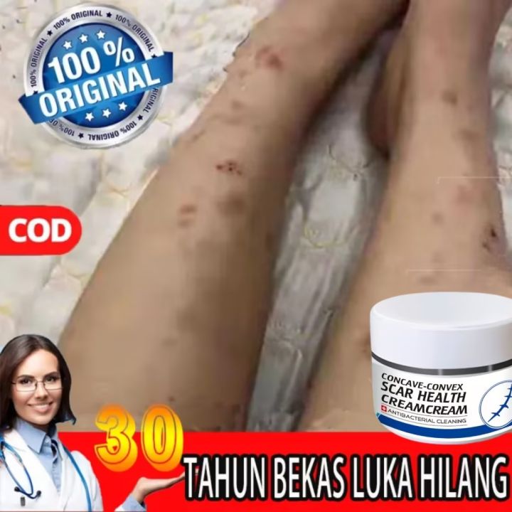 100 Effective Scar Cream Original Scar Remover Peklat Remover Cream