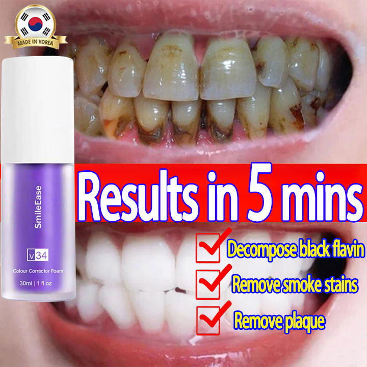 Smile Ease TOOTHPASTE V34 teeth whitening colour corrector stain ...
