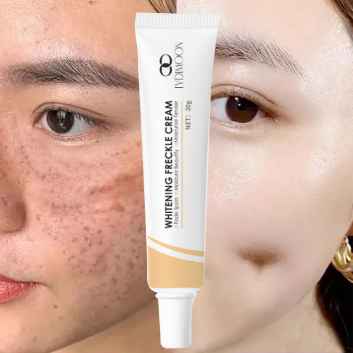 LYDIMOON Cream penghilang flek hitam whitening Krim anti bintik dan ...