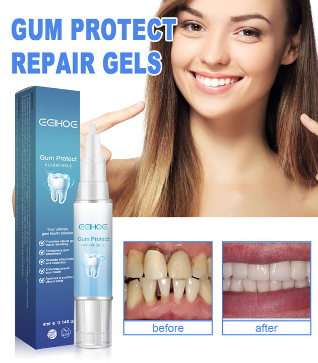 Oral care repair gel deep cleaning tartar repair gel gum swelling and ... Oral care repair gel deep cleaning tartar repair gel gum swelling and ...