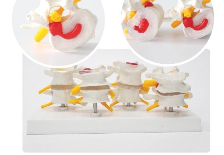 *ship from m'sia* Life-Size Human Normal Lumbar Vertebrae Model ...