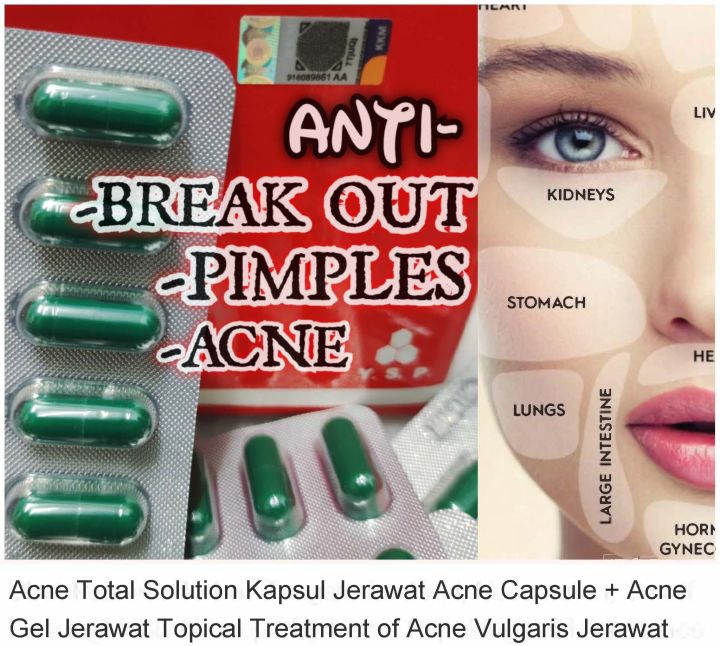 Acne Total Solution Kapsul Jerawat Acne Capsule + Acne Gel Jerawat ...