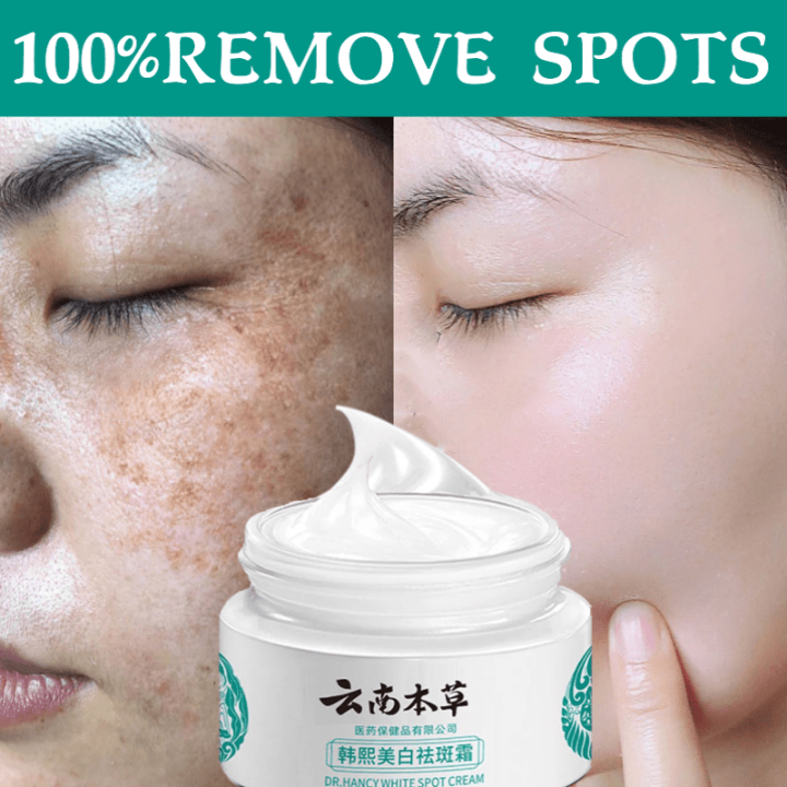 Japanese Melasma Cream | Original High Moisturizing Blemish Cream ...