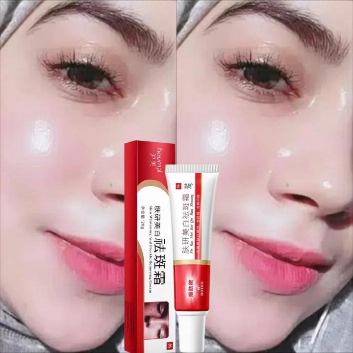 Whitening Freckle Cream 20g Cream Wajah Glowing Permanen Dalam Krim ...