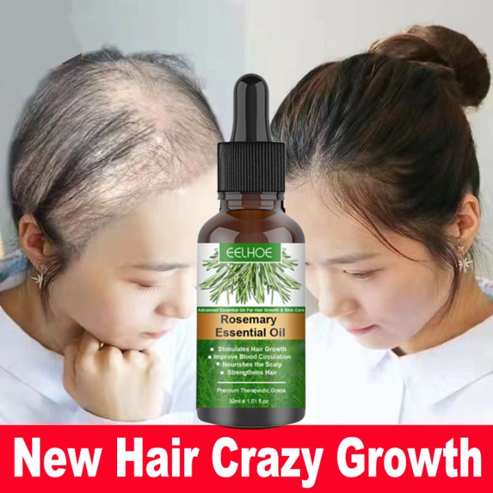 Hair Serum Hair Growth Serum 10 X Faster 30ML Rosemary Essential Oil ...