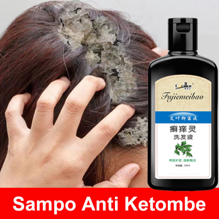 Shampo anti ketombe Sampo anti ketombe Shampoo anti ketombe dan pengontrol minyak Anti ketombe ...