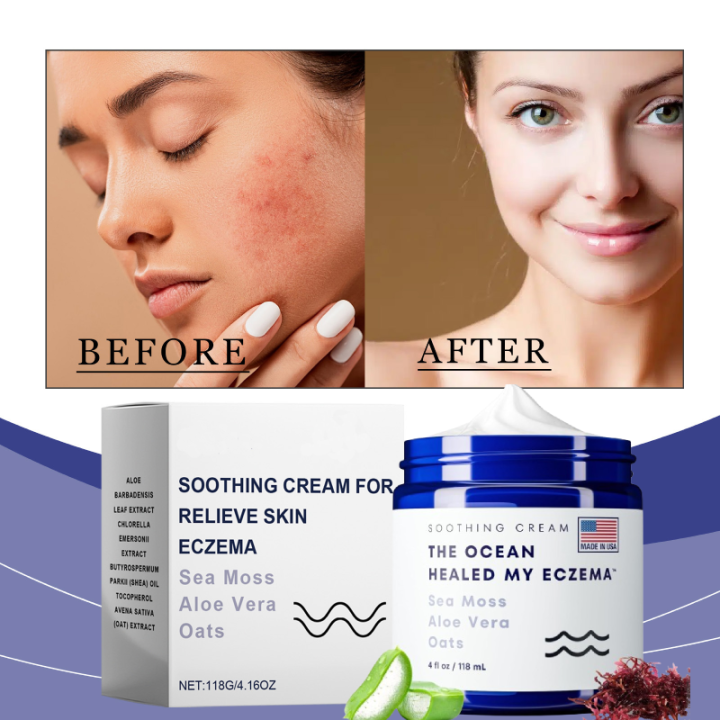 Ocean Natural Eczema Relief Cream Gentle Non-greasy Boosts Moisture ...