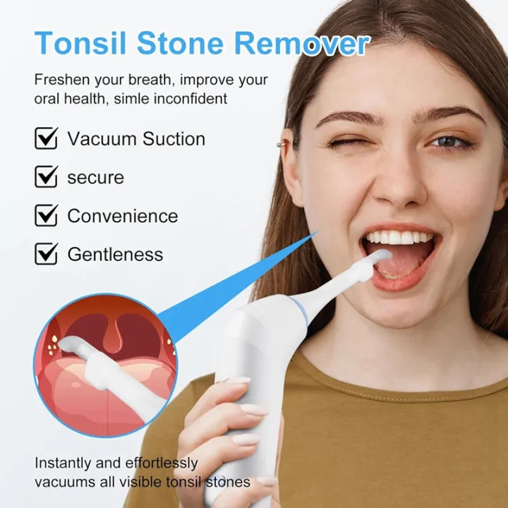 Tonsil Stone Removal Kit with Electronic Tonsil Stone Remover, Camera ...