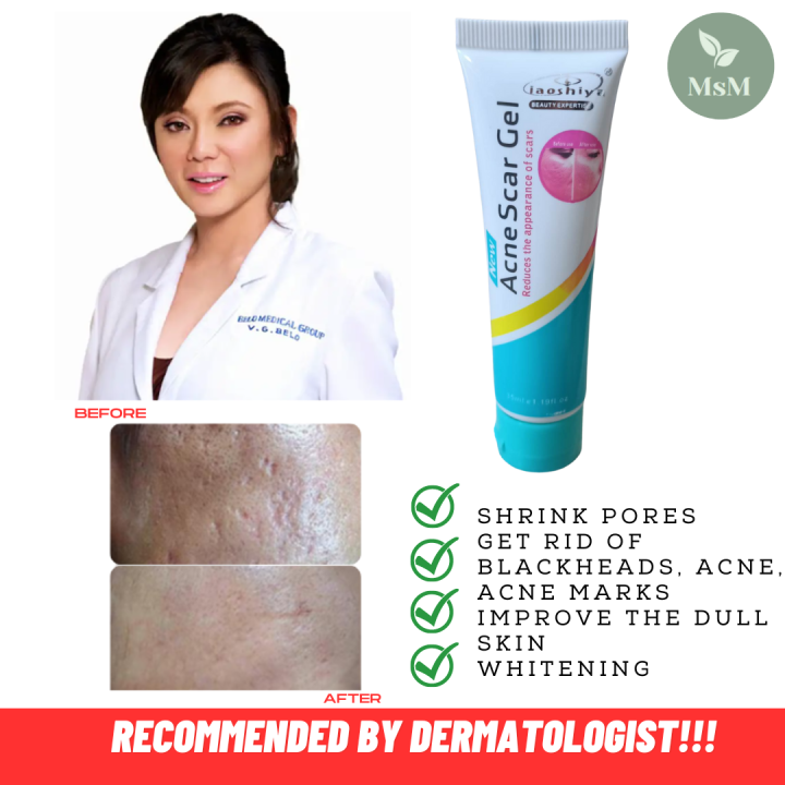 MsM BEST CREAM FOR ACNE SCARS ACNE SCAR GEL Scar remover Face ...