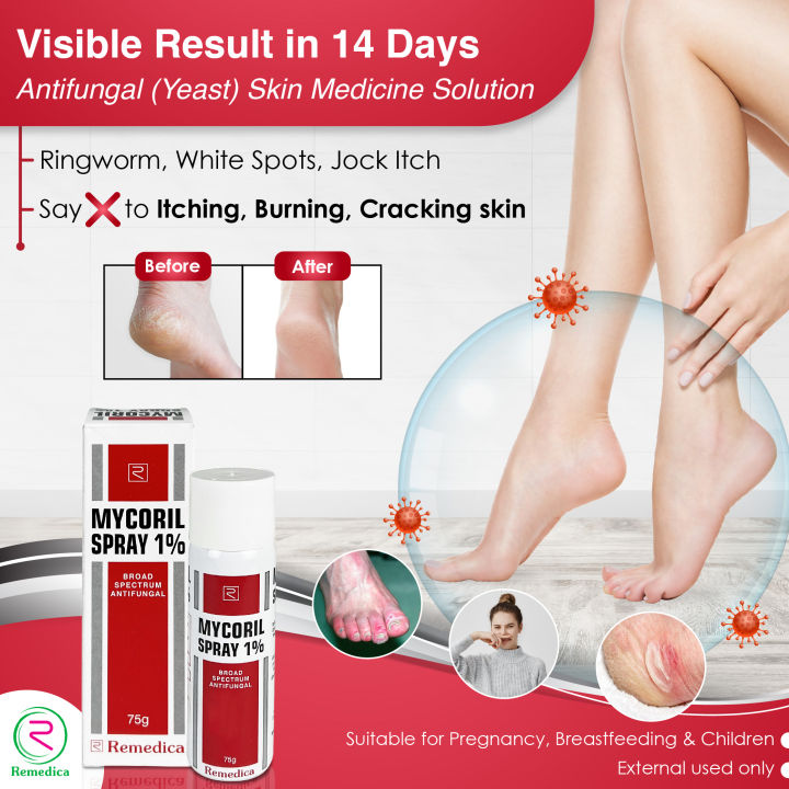 Mycoril Antifungal Foot/ Toes/Nail Medicine Non-greasy Spray 75g ...