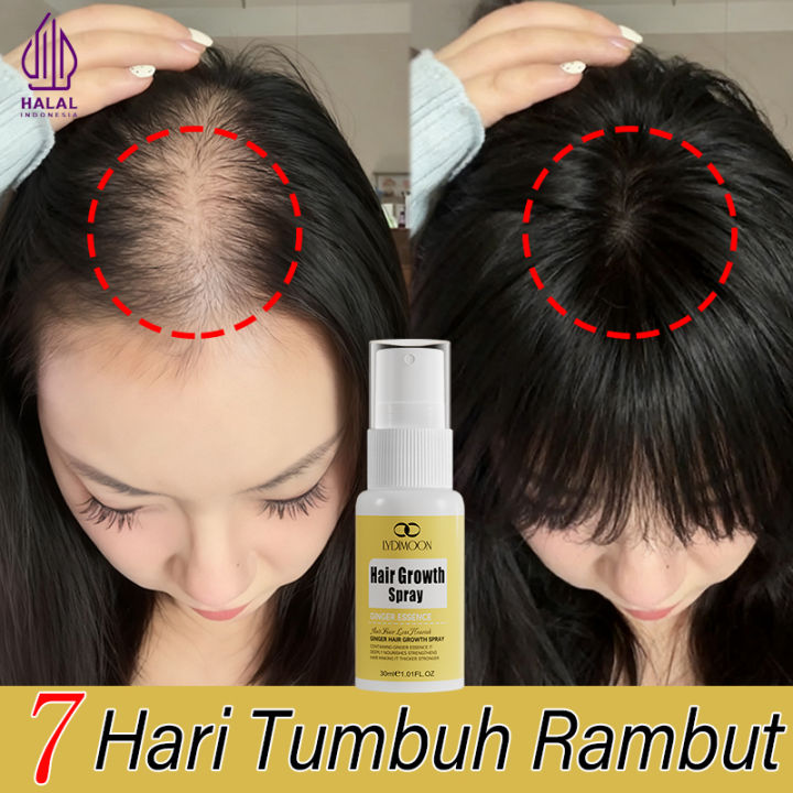 Semprotan Penumbuh Rambut Jahe Alami -Mendorong Pertumbuhan Cepat ...