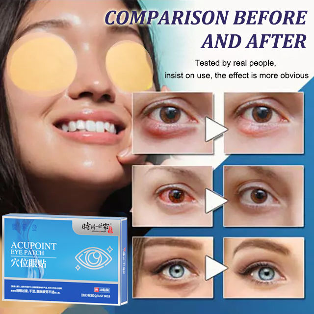 Acupoint Eye Patches for Relieving Eye Strain Dryness and Puffiness ...