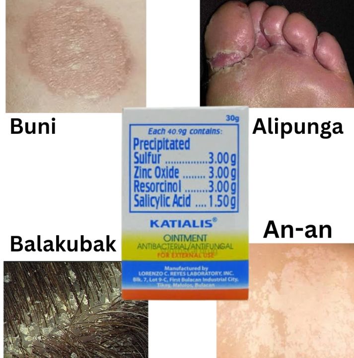 Anti-fungal/bacterial Ointment: Mabisa sa An-an, Buni, Alipunga ...