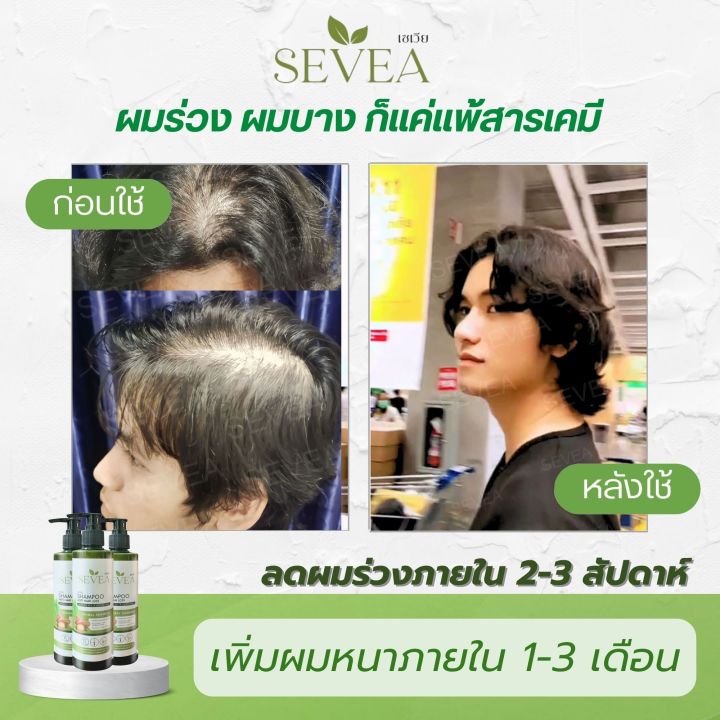 SEVEA เซเวีย แชมพูลดผมร่วง ลดผมบาง ลดรังแค ขจัดรังแค ลดผมมัน ยาสระผม ...