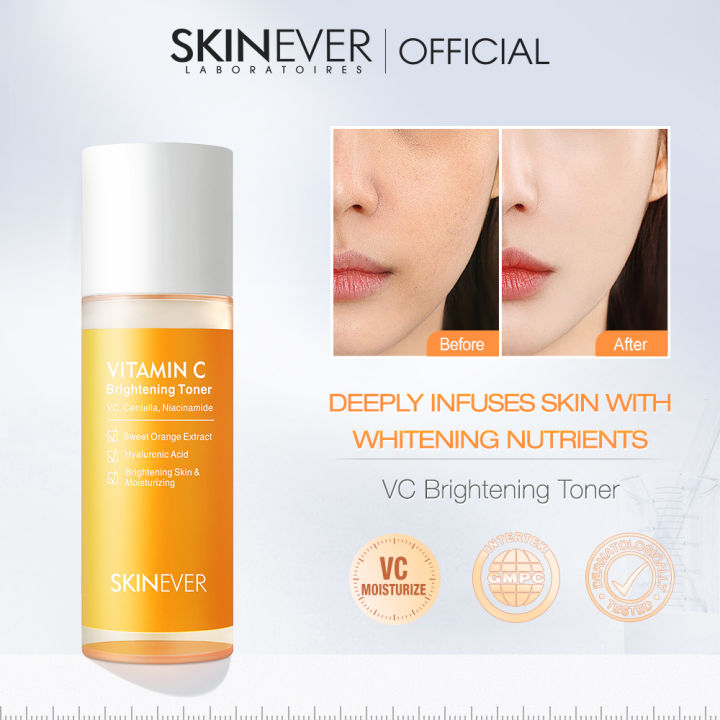 SKINEVER Vitamin C Brightening And Whitening Facial Toner Hydration ...