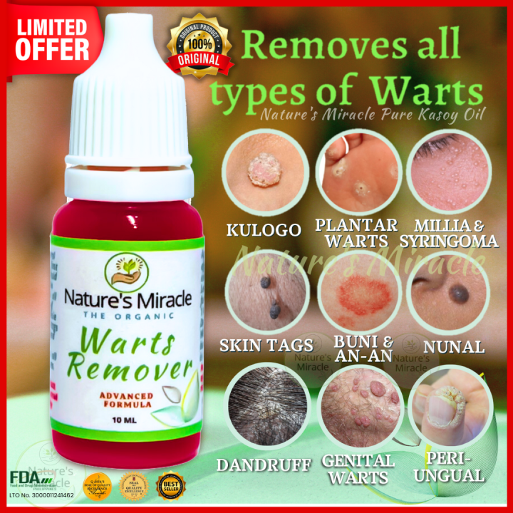Nature's Miracle Warts Remover Pure Kasoy Oil Warts Remover Original ...