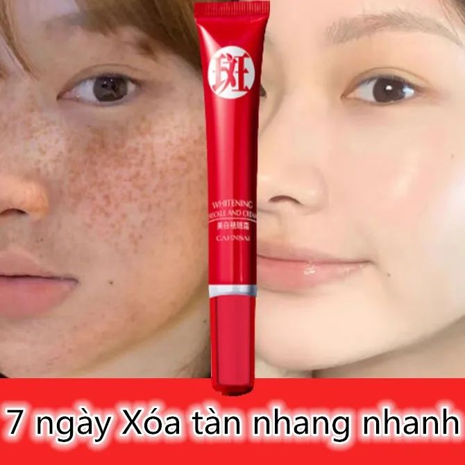 Whitening and Freckle Removing Cream Whitening Serum Light spots ...