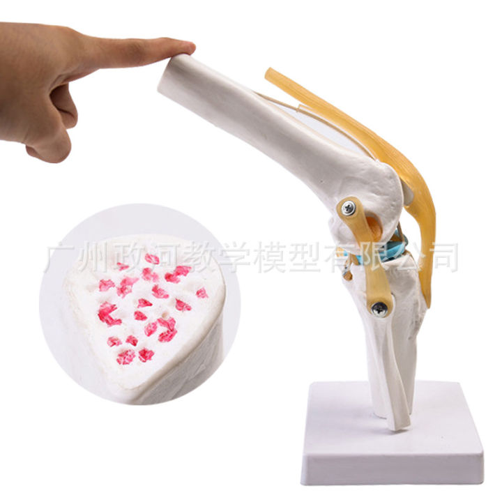 Life Size Human Knee and Knee Ligament Model Femur Lateral Condyle ...