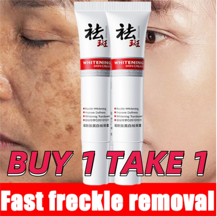 【BUY 1 TAKE 1】Effective freckle removal whitening cream melasma removal ...