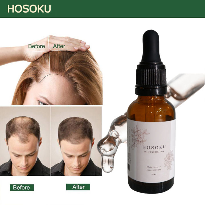 Minoxidil 15 Hosoku Hair Growth With Collagen And Castor Oil Hair